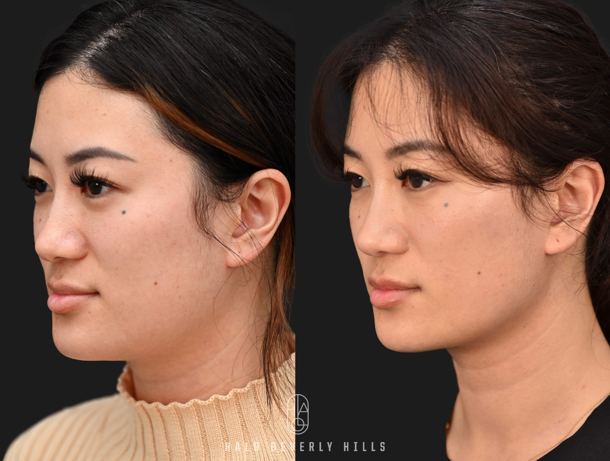 Oligio X - Halo Beverly Hills